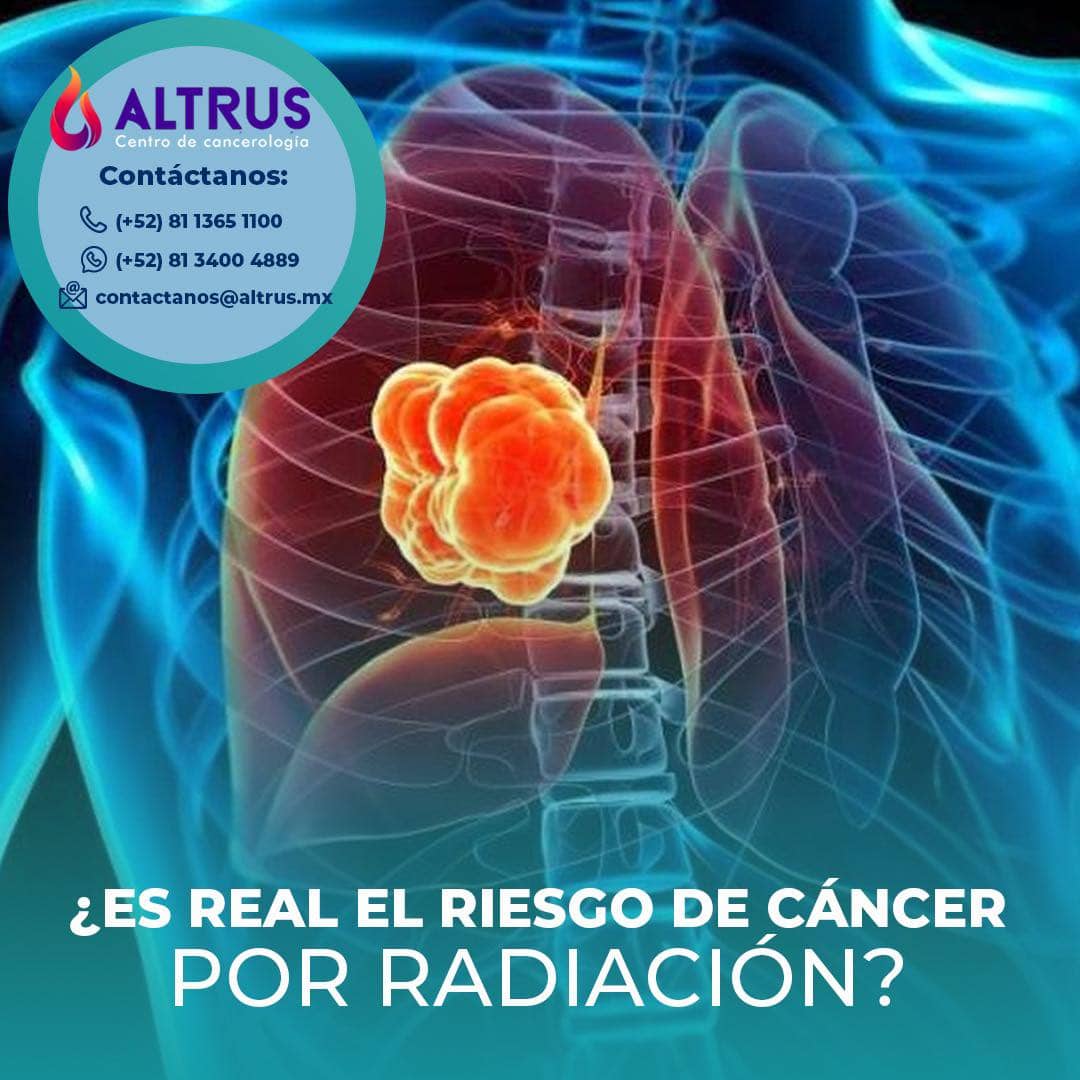 Radiación - ALTRUS cancerología